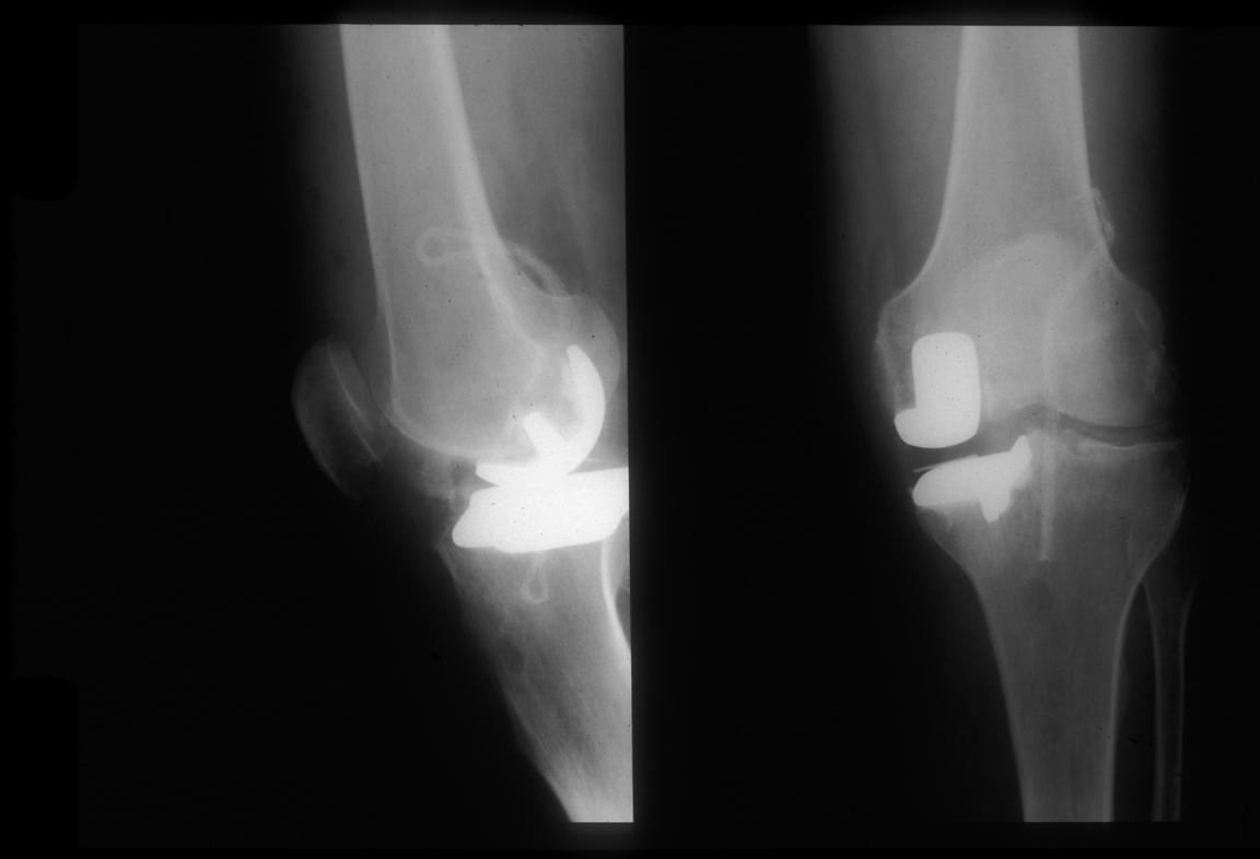 Let’s Talk About Fear – Literary Arts Blogspace